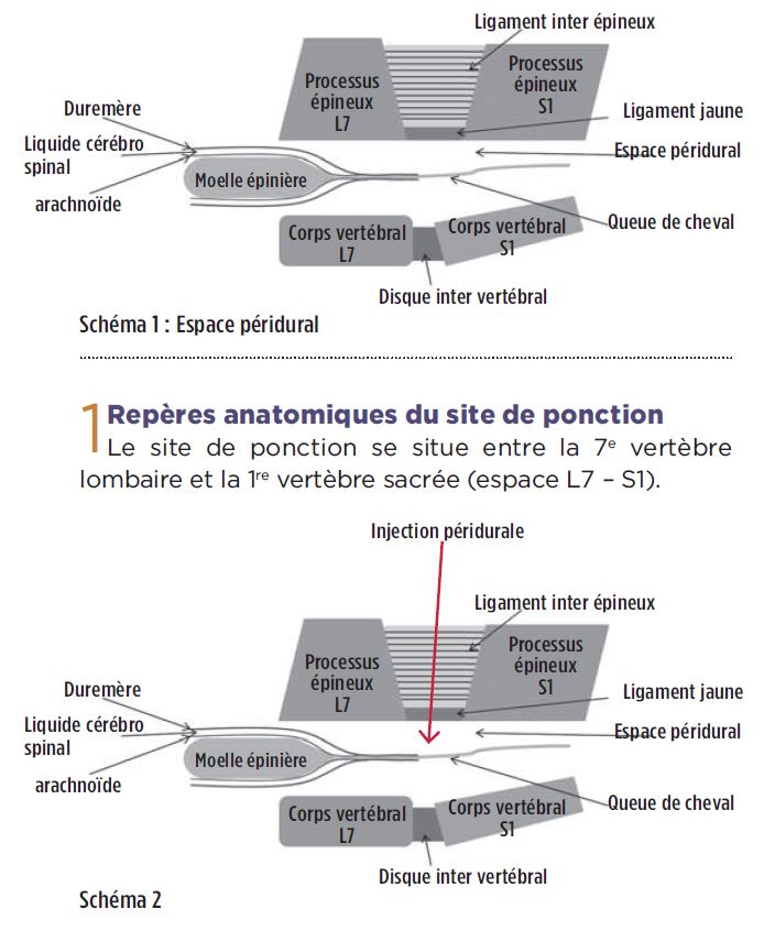 La péridurale chez le chien | CHV Meaux